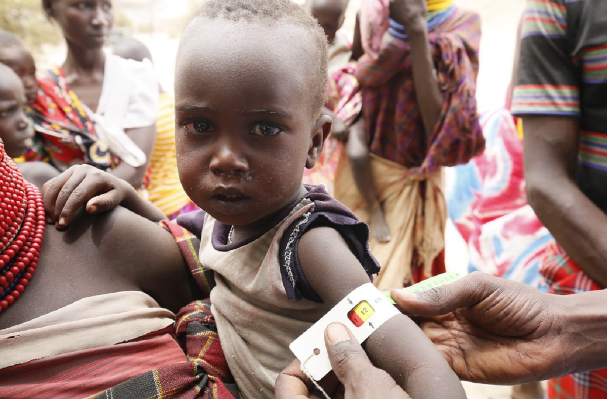 World Hunger Statistics - All You Need To Know!